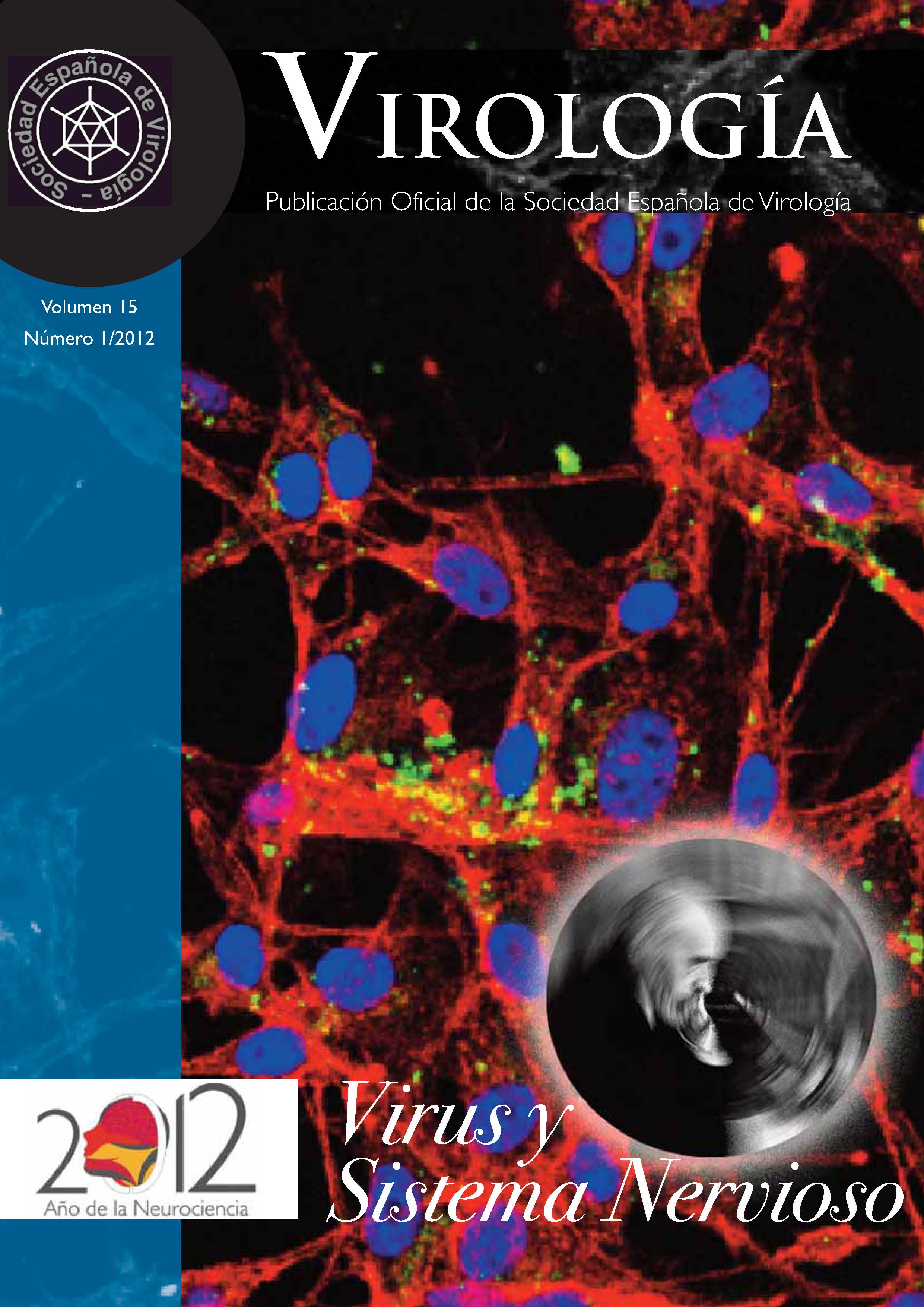 VIH : Reservorio viral latente y política. SIDA STUDI