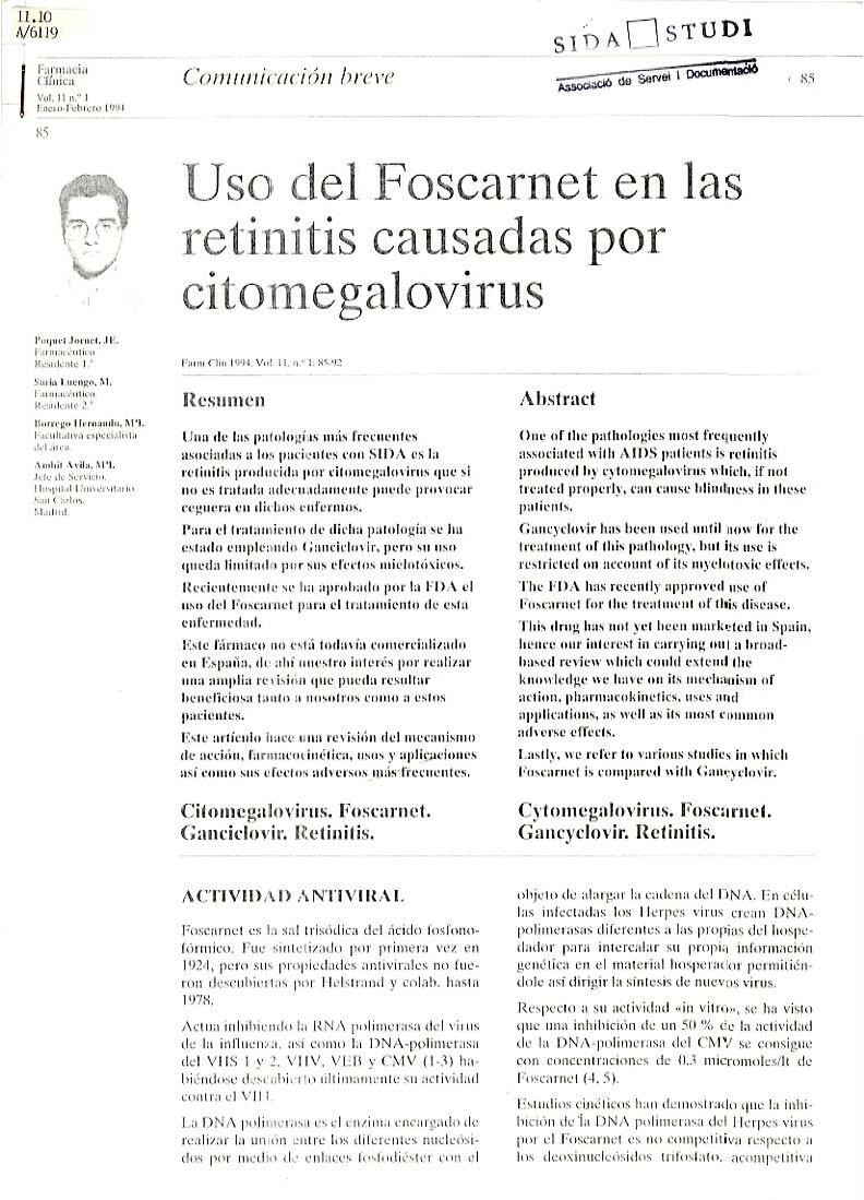Uso del foscarnet en las retinitis causadas por citomegalovirus. SIDA STUDI